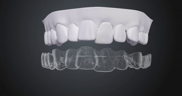 Animations Aligner therapy - MedicalGraphics