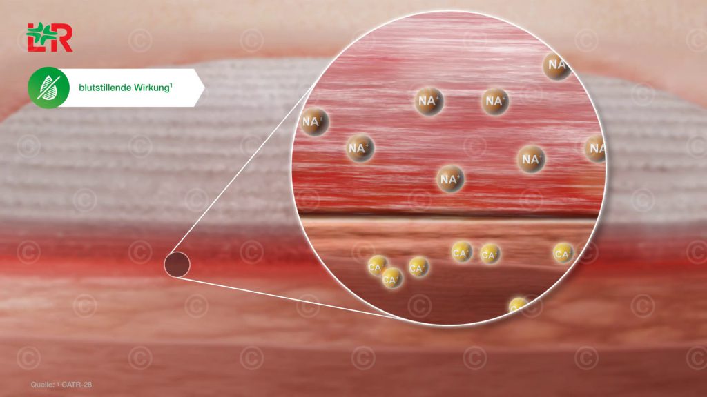 Animation Wundauflage Suprasorb A Pro - MedicalGraphics