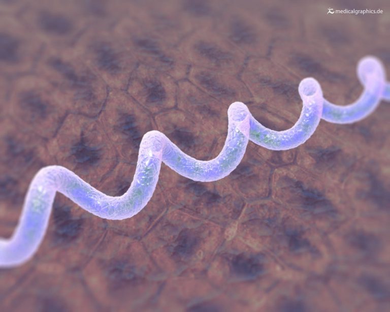 Free illustration Lyme disease bacteria