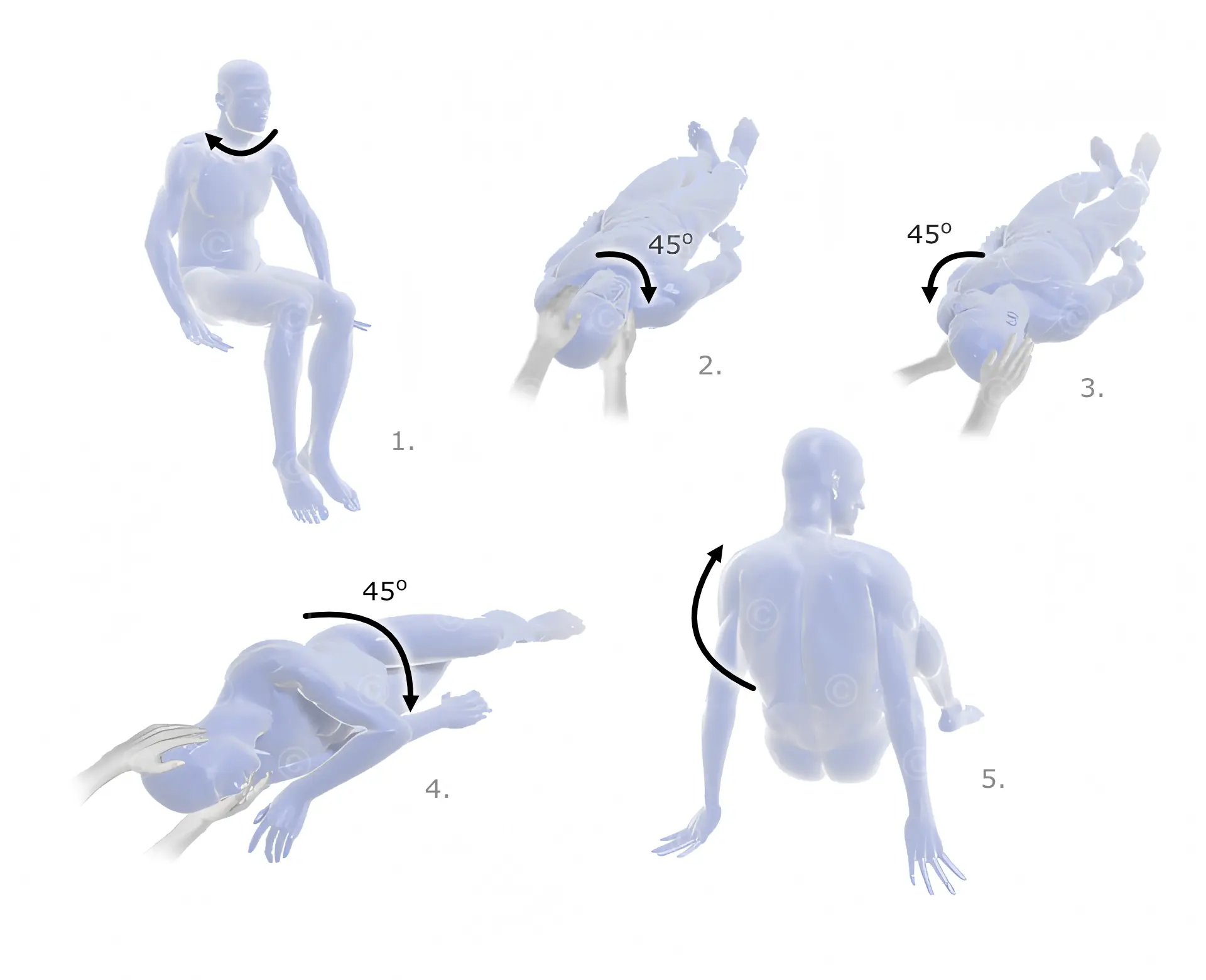 Epley Maneuver Illustration