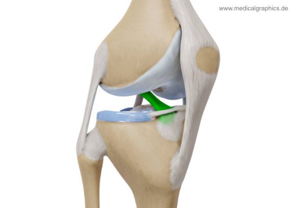 Anterior cruciate ligament - MedicalGraphics
