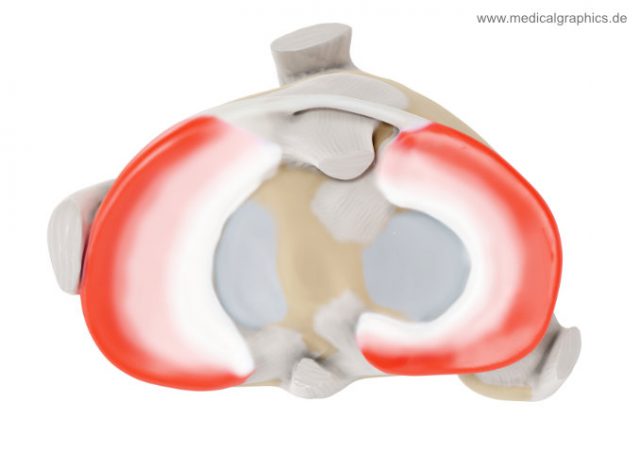 Zones blood flow meniscus - top - MedicalGraphics