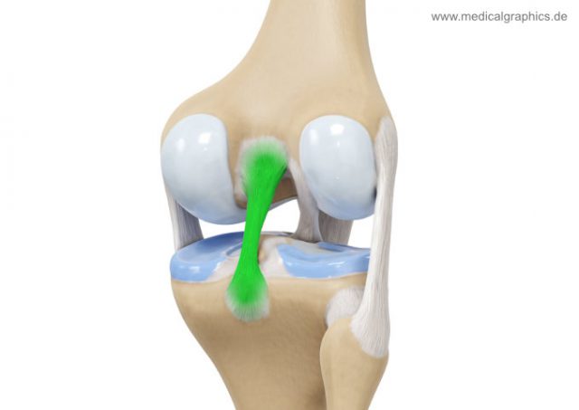 Posterior cruciate ligament - PCL - MedicalGraphics
