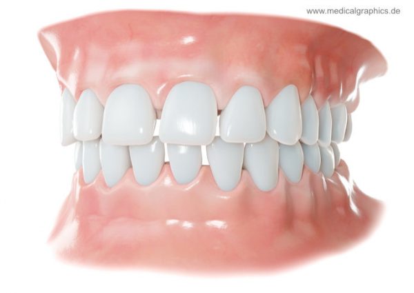 Gap teeth - malocclusion - MedicalGraphics